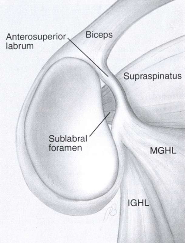SLAP Lesion - Shoulder & Elbow - Orthobullets